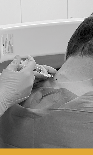 Cervicale epidurale infiltratie - PIJNCENTRUM GENT