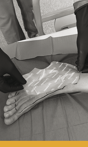 Behandeling met Qutenza® huidpleister - PIJNCENTRUM GENT